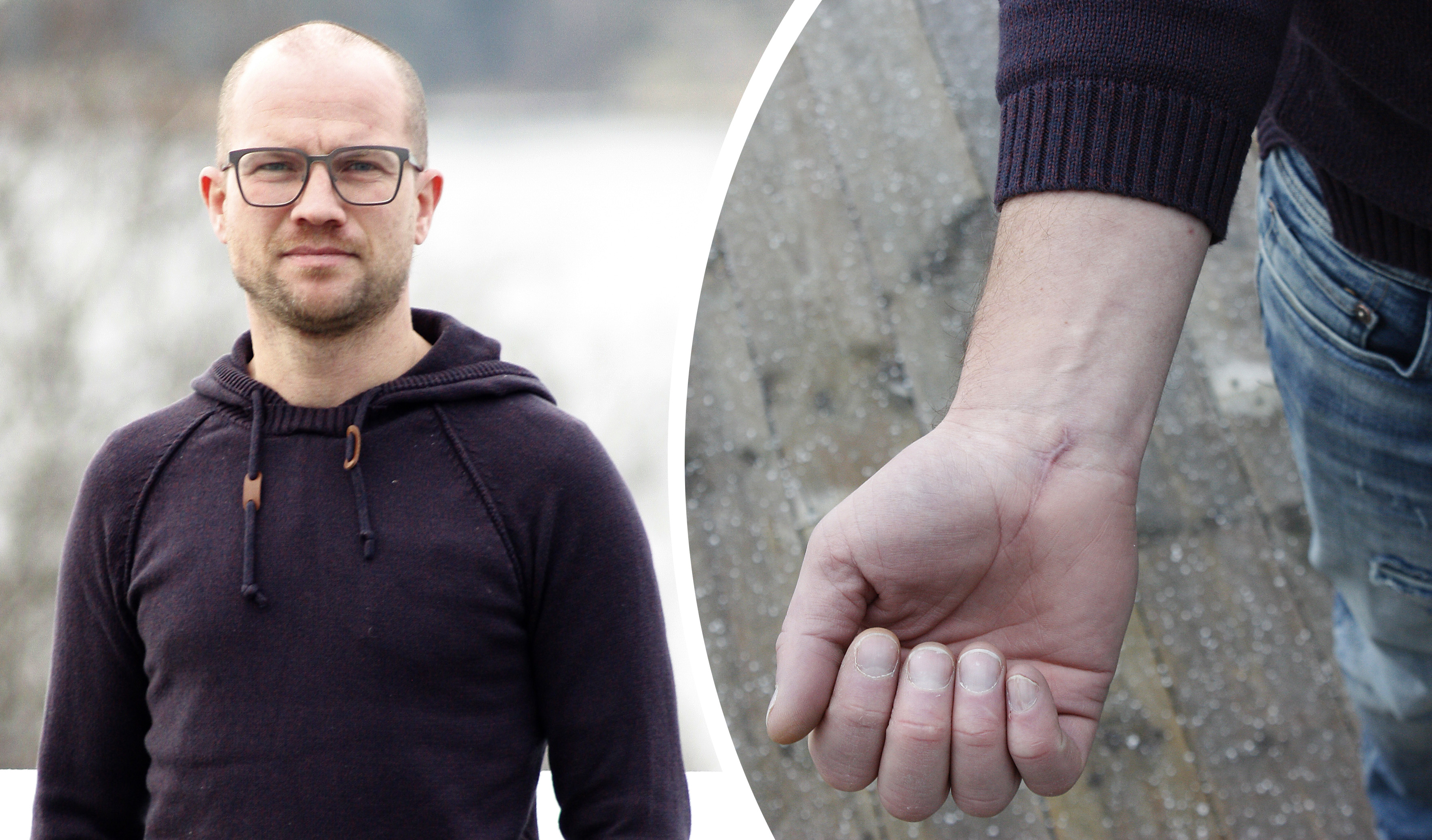 Vibrationsskador: Bilade i nio månader i sträck – Arbetet