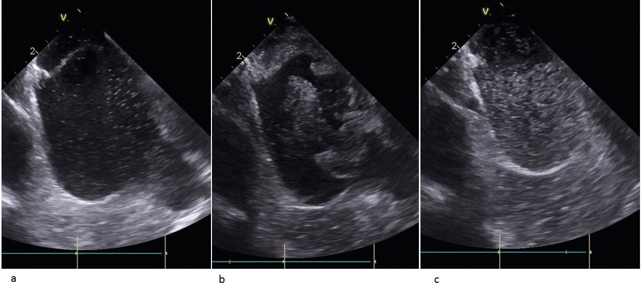 Magnus Settergren – Läkartidningen