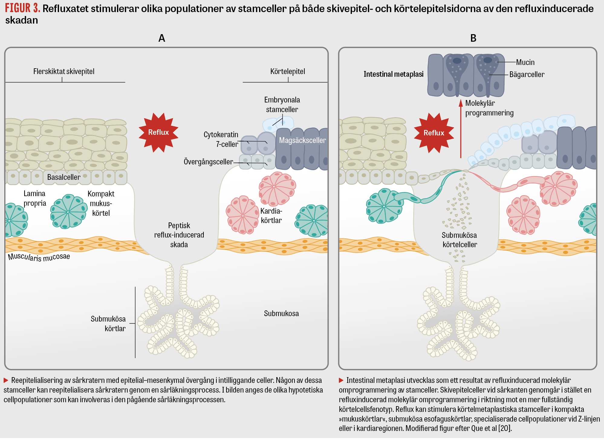 Diagnos, behandling, risk och kontroll vid Barretts esofagus ...