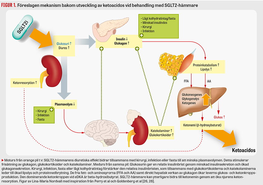 SGLT2-hämmare och ketoacidos – Läkartidningen