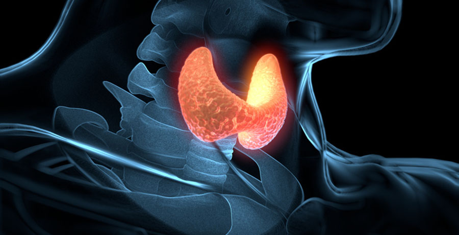 SGLT2-hämmare och ketoacidos – Läkartidningen