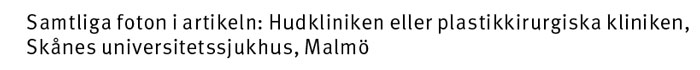Vaskulära lesioner, del 1: – Läkartidningen