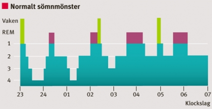 Restless legs – vanligt sjukdomstillstånd som ofta missas – Läkartidningen